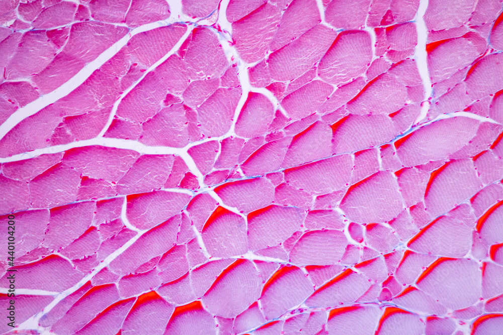 Characteristics of anatomy and Histological sample Striated (Skeletal ...