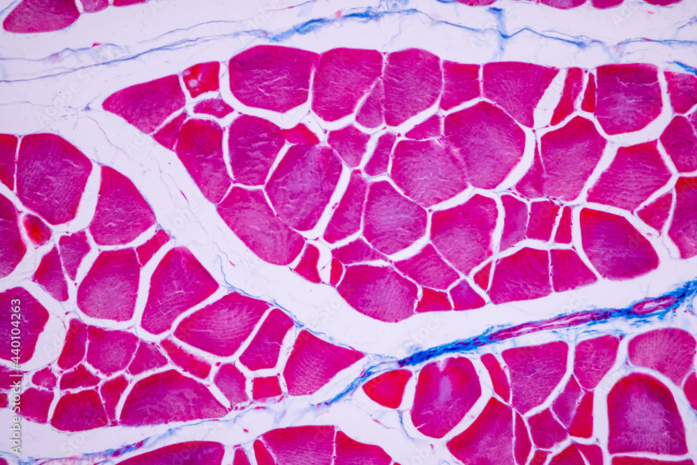 Characteristics of anatomy and Histological sample Striated (Skeletal ...