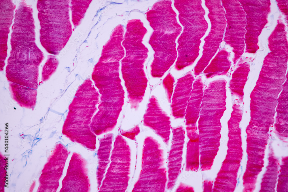 Characteristics of anatomy and Histological sample Striated (Skeletal ...