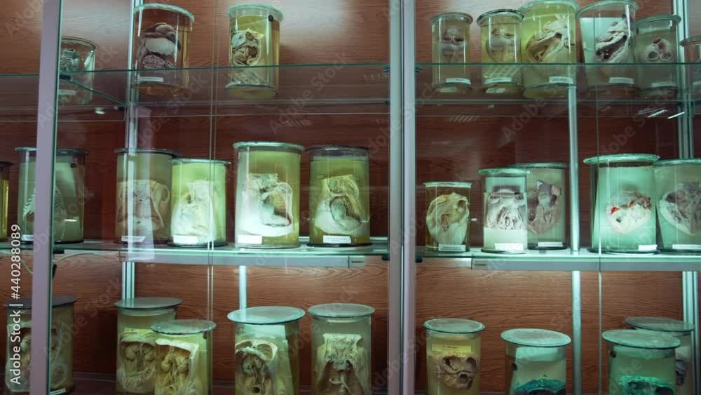 Large collection of human organs in anatomical museum. Different parts ...