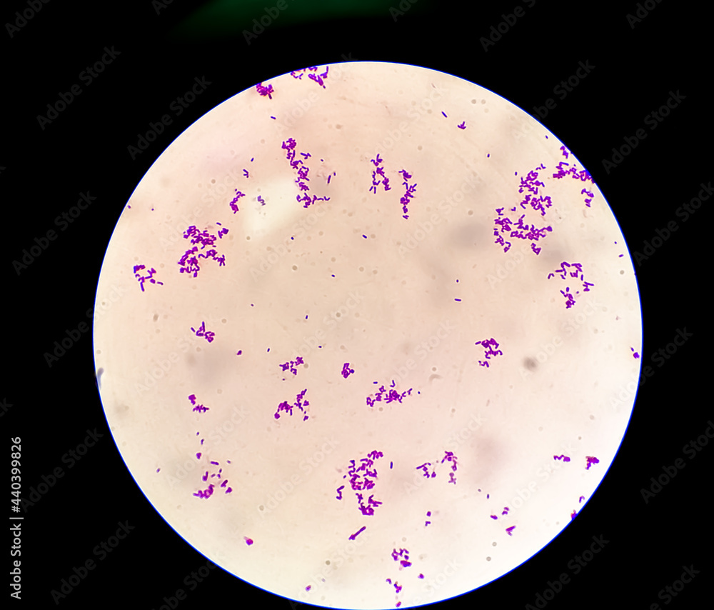 Streptococcus Bacteria Gram Stain