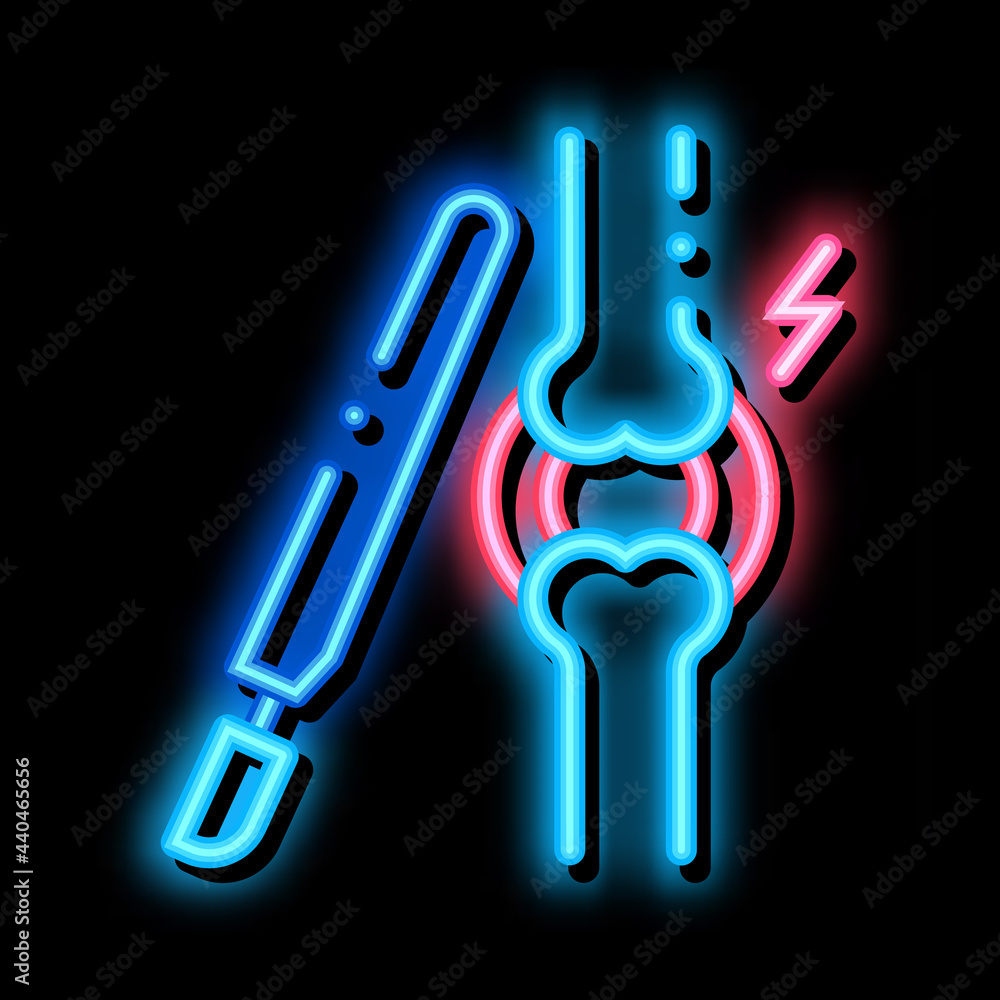 arthroscopy check neon light sign vector. Glowing bright icon ...