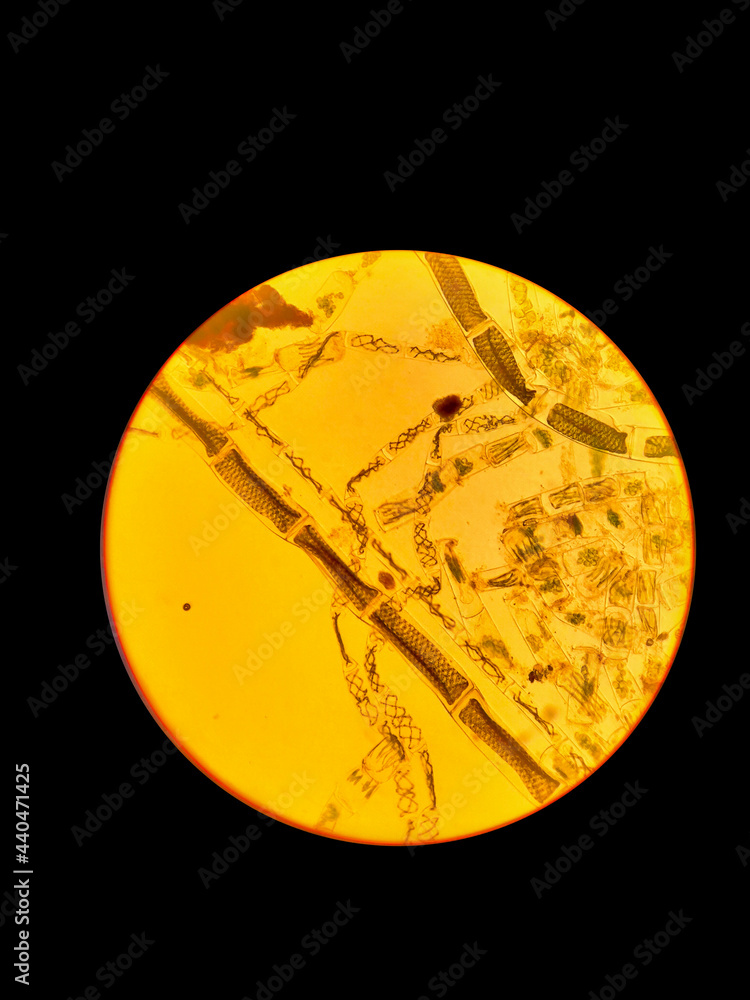Dirty water sample under a microscope. Algae zignema and spirogyra ...