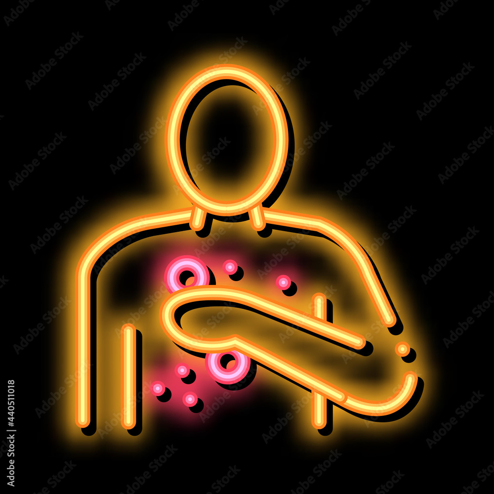 human rash problem neon light sign vector. Glowing bright icon human ...