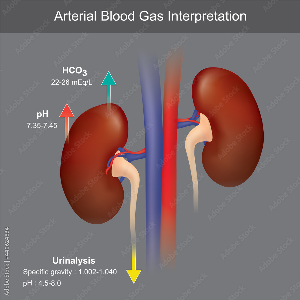 Arterial Blood Gas Interpretation Stock Vector | Adobe Stock