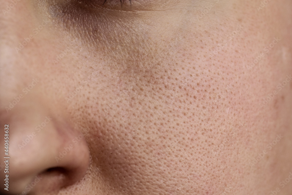 The texture of the pores of the skin of the cheeks and the area under ...