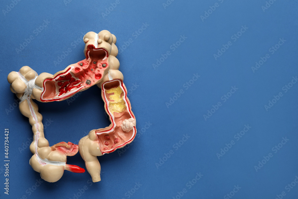Anatomical model of large intestine on blue background, top view with ...