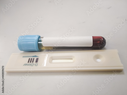 Close up view a device and sample tube of D-Dimer rapid screening test ...