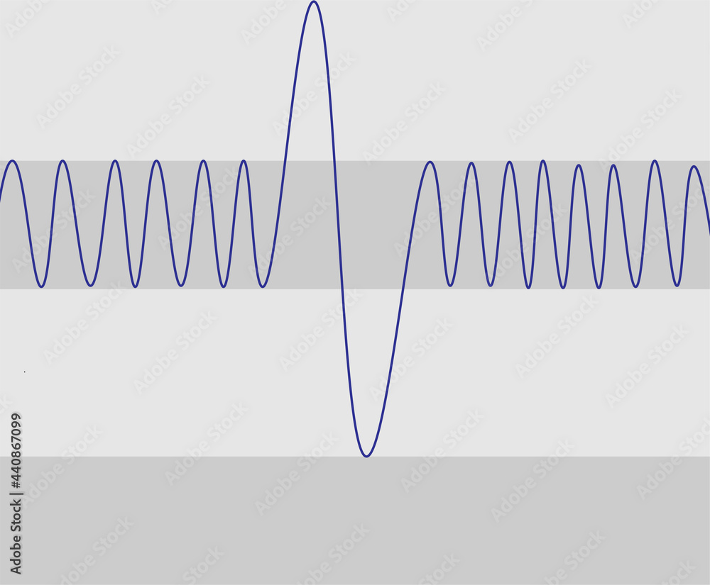 Spirometry Curve Analyses Illustration Of Spirometry Curves Stock Illustration Adobe Stock