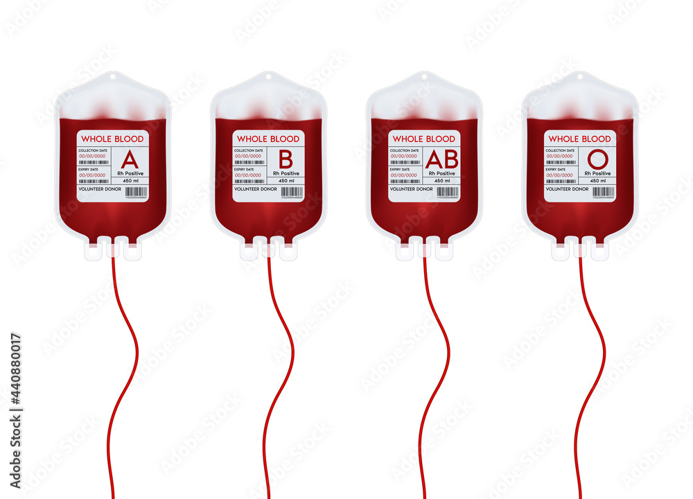 Blood bag with label different blood group A system. Blood donation ...