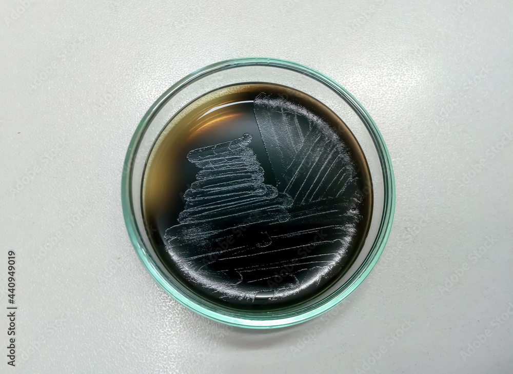 Bacterial colonies on bile esculin agar media in microbiology ...