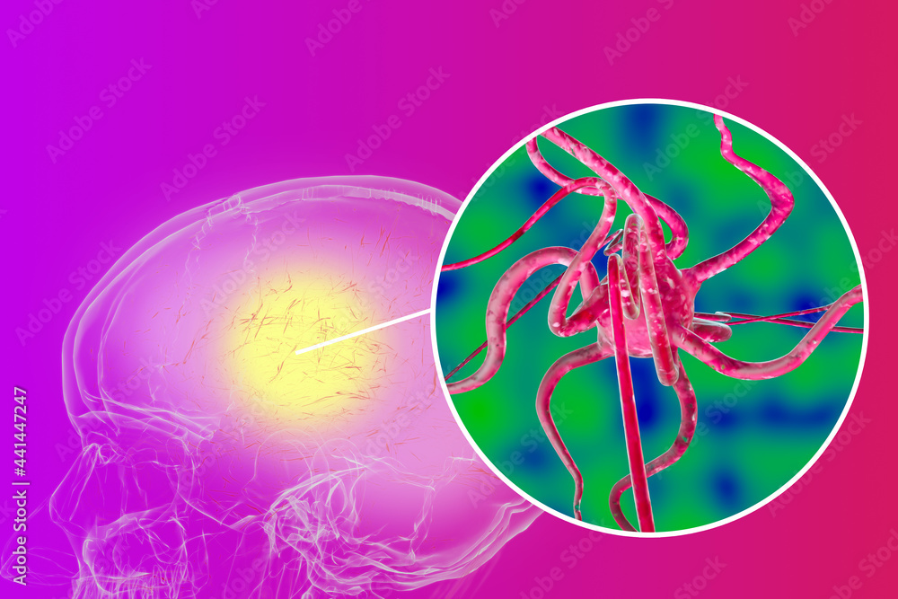 The concept of diseases affecting the normal functioning of the ...