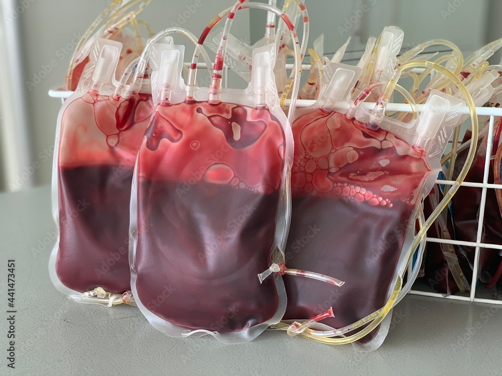 Blood container for transfusion. Red blood cells. Stock Photo | Adobe Stock