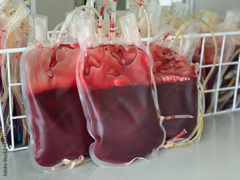 Blood container for transfusion. Red blood cells. Stock Photo | Adobe Stock