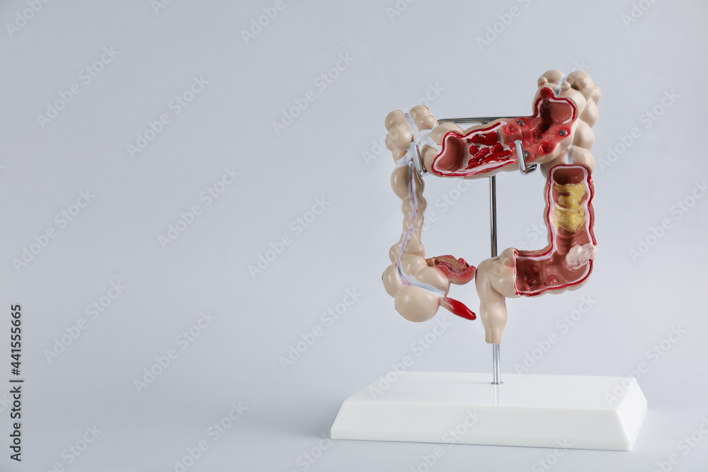 Human colon model on light grey background. Space for text Stock Photo ...