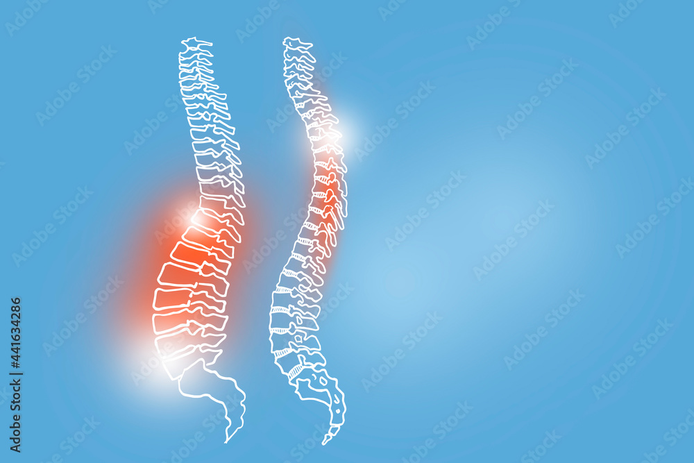 Handrawn illustration of human Spine on light blue background. Medical ...