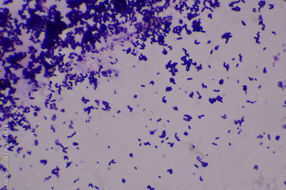 Gram positive baclli chines letter finding with microscope. Stock Photo ...