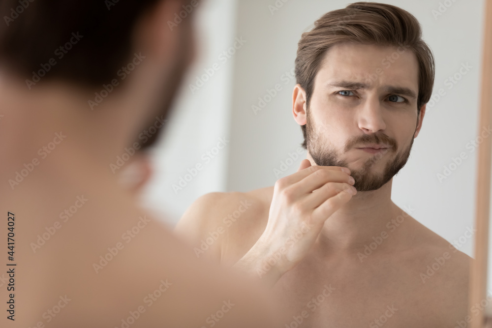 Worry young handsome man examining face in mirror reflection, touching ...