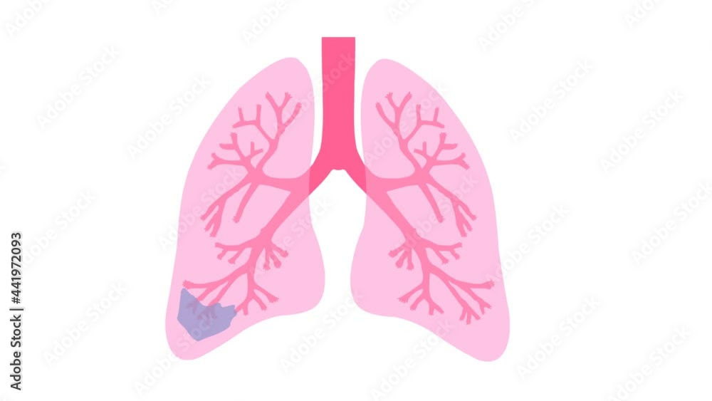 Animation of lungs of a person and breathing (or ventilation) of a ...