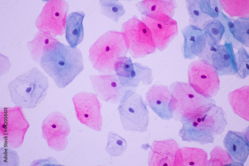 Normal squamous epithelial cells of cervical human view in microscopy ...