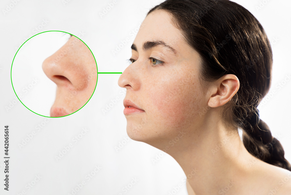 Portrait of young caucasian woman showing her crooked nose and zoom ...