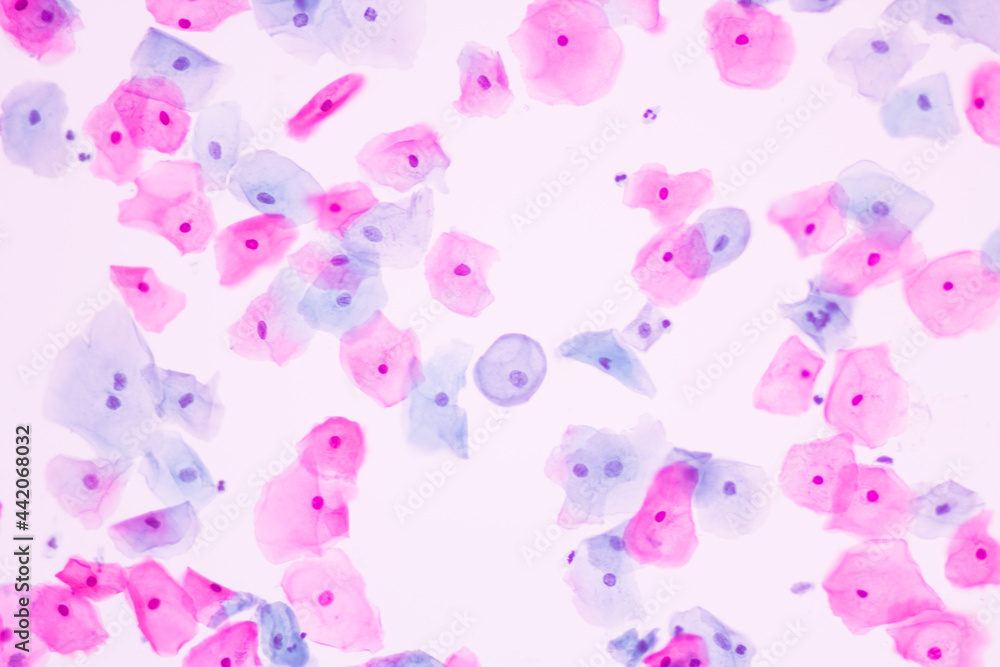 Normal squamous epithelial cells of cervical human view in microscopy ...