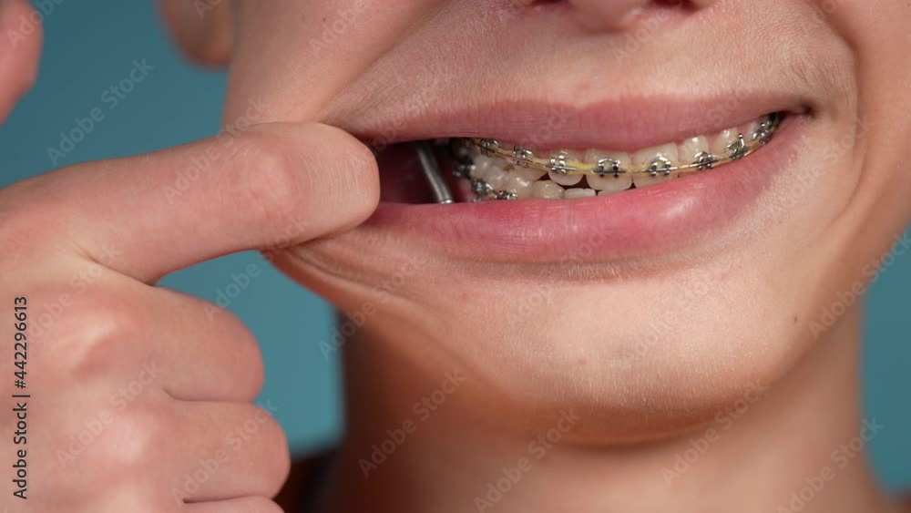 Closeup view 4k video footage of metal spring inside of mouth of ...