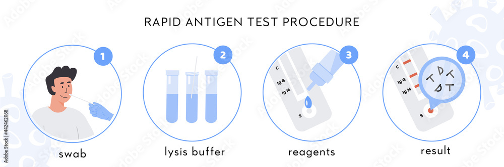 Poster Covid-19 Rapid Antigen test procedure Infographic – Wall Art ...