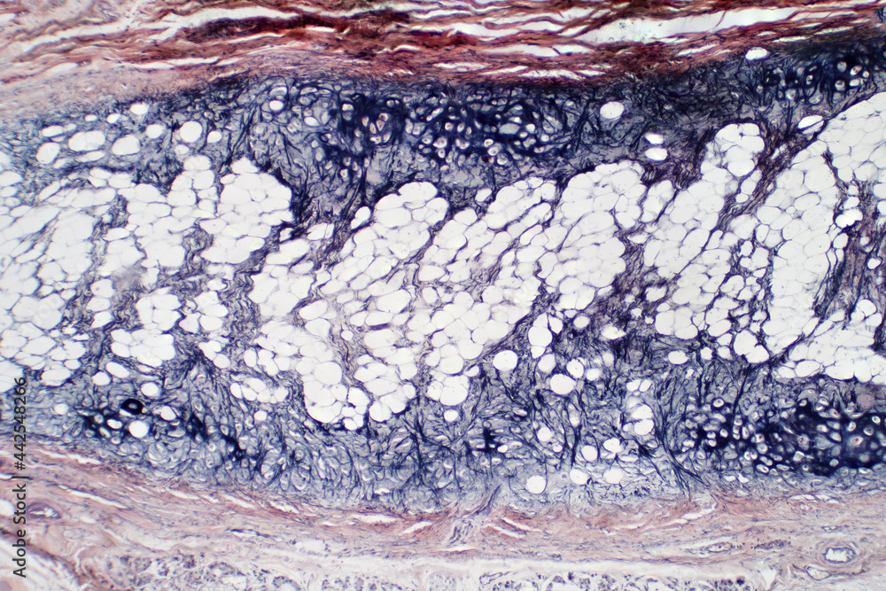 Cross section human cartilage bone under light microscope view for ...