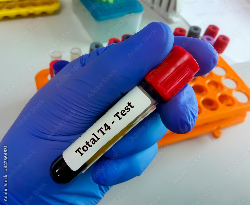 Blood sample in test tubes for Total T4 test, diagnosis of ...