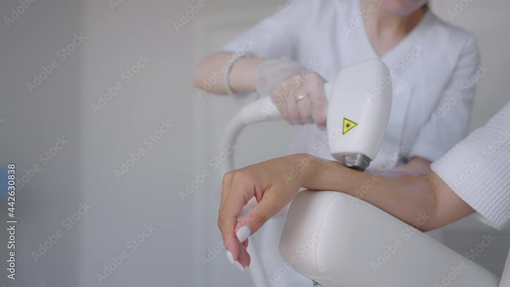 Procedure of removing hairs on hand. Laser hair removal on a diode ...
