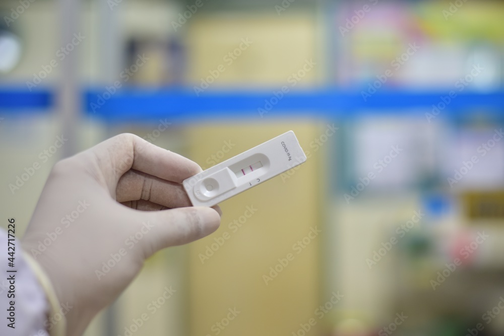 Strip test Covid-19 antigen positive. Stock Photo | Adobe Stock