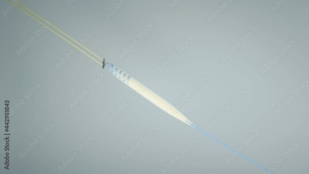 Knee surgery, torn tendon repair, ligament repair, pins, bone drilling ...