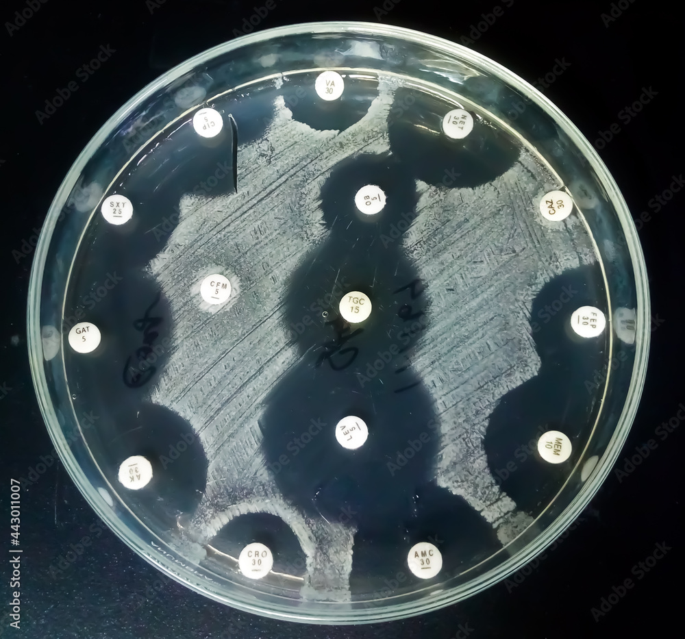 Antimicrobial susceptibility testing in petri dish. Antibiotic ...