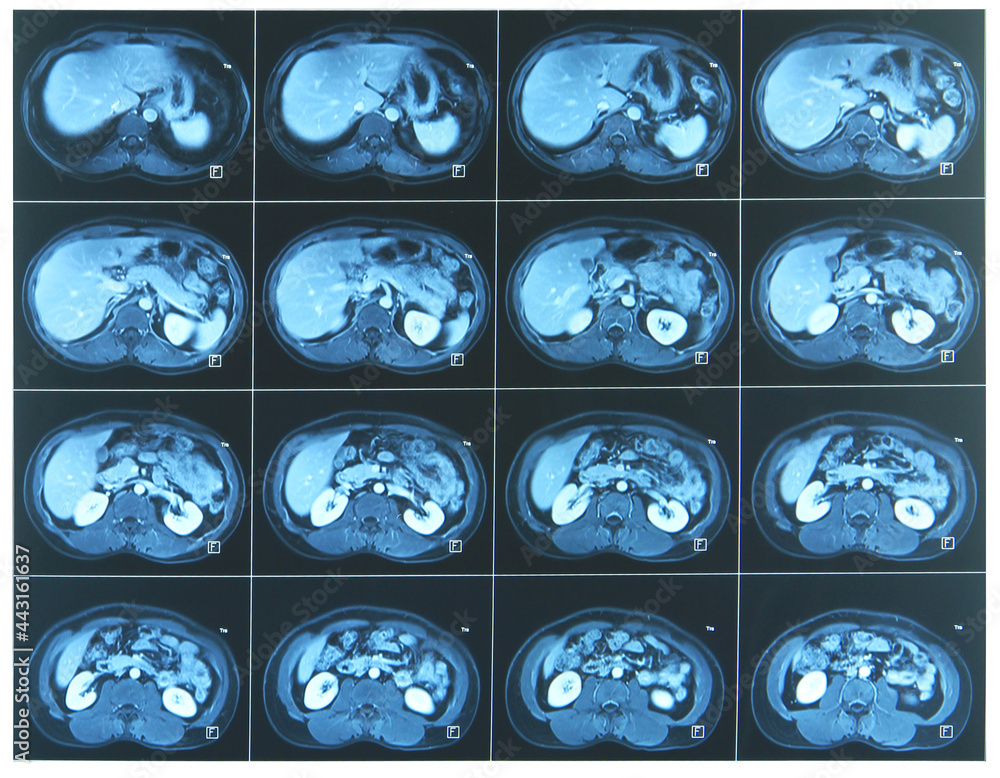 Abdomen MRI scan Stock Photo | Adobe Stock