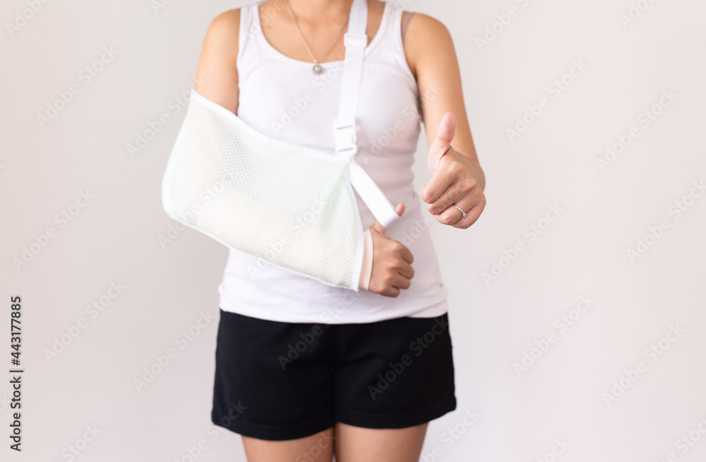 Patient woman wearing arm sling and showing thump up for relieve broken ...