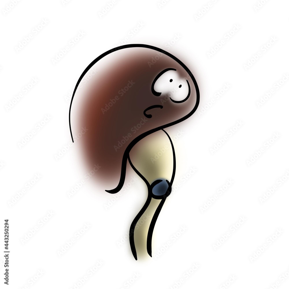 Kidney and stuck stone in the ureter Stock Illustration | Adobe Stock