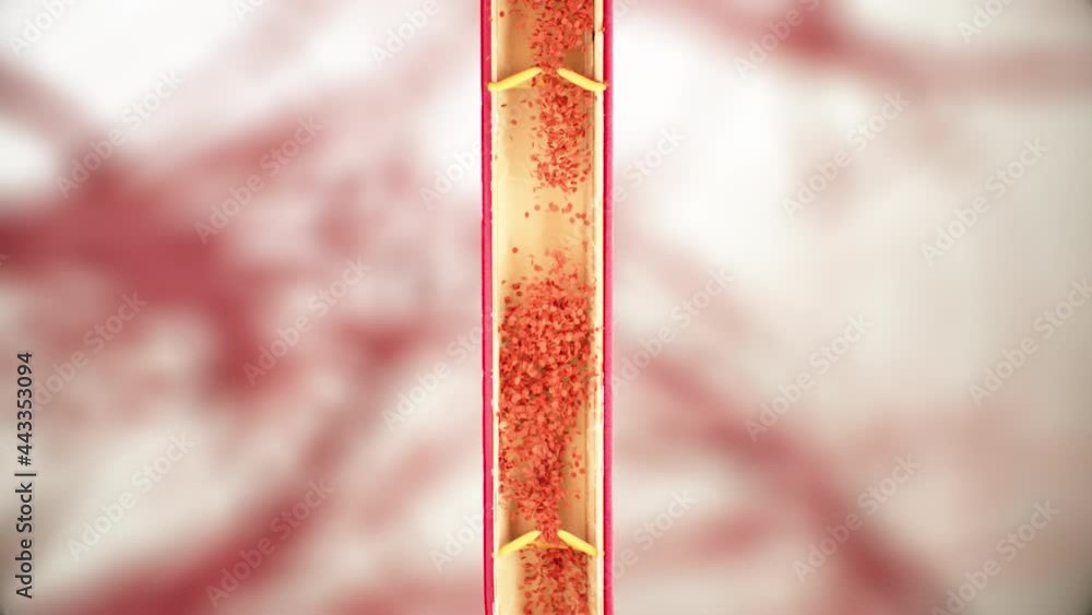 Leg vein anatomy, venous valve function, blood flow, erythrocytes ...