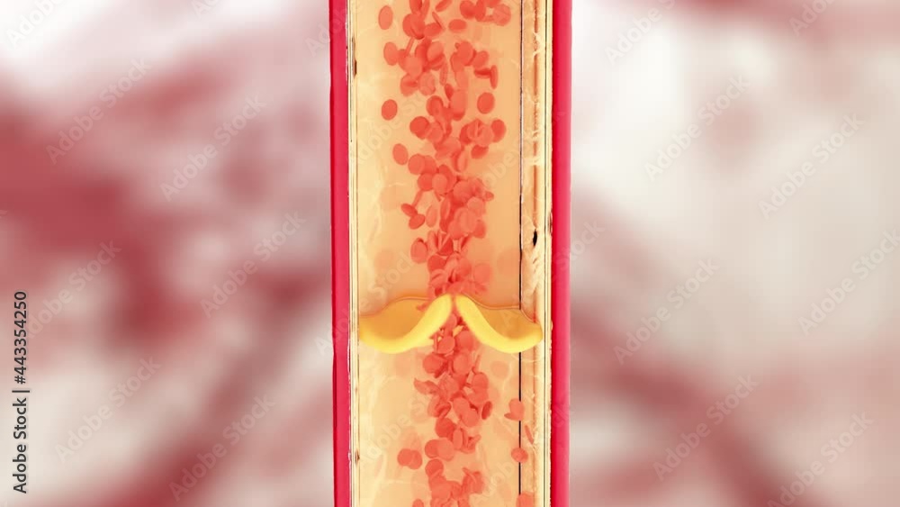 Leg vein anatomy, venous valve function, blood flow, erythrocytes ...