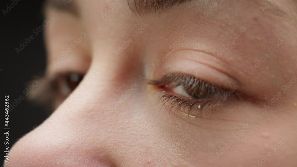 Close-up of crying brown eyes, watery eye of young woman, shooting of ...