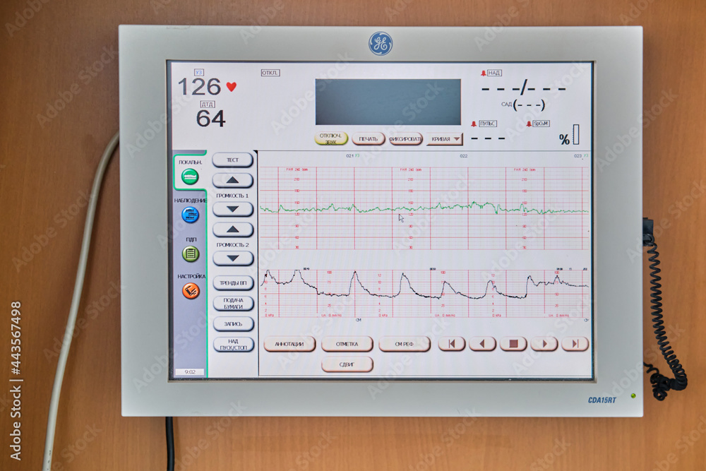 CTG device with monitoring of the state of health of the mother and ...