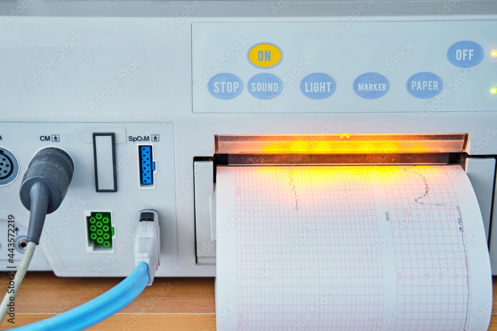 CTG device with monitoring of the state of health of the mother and ...