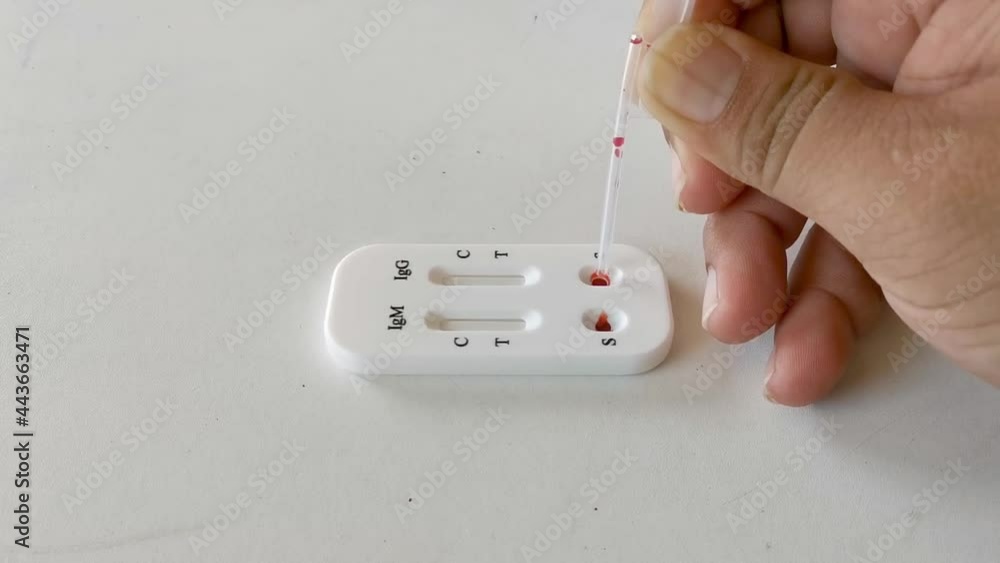 A quick and easy test kit is a preliminary screening test for the ...