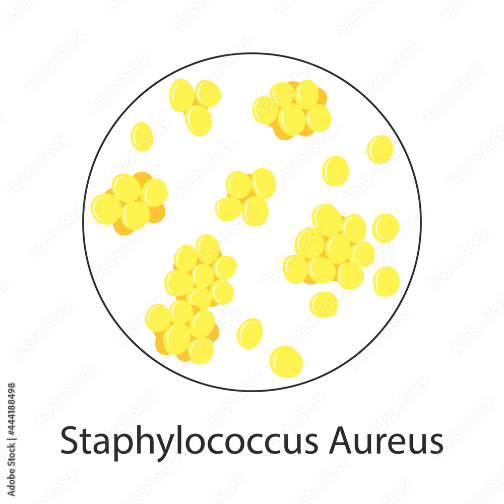 bacteria Staphylococcus Aureus isolated on white background. Vector ...