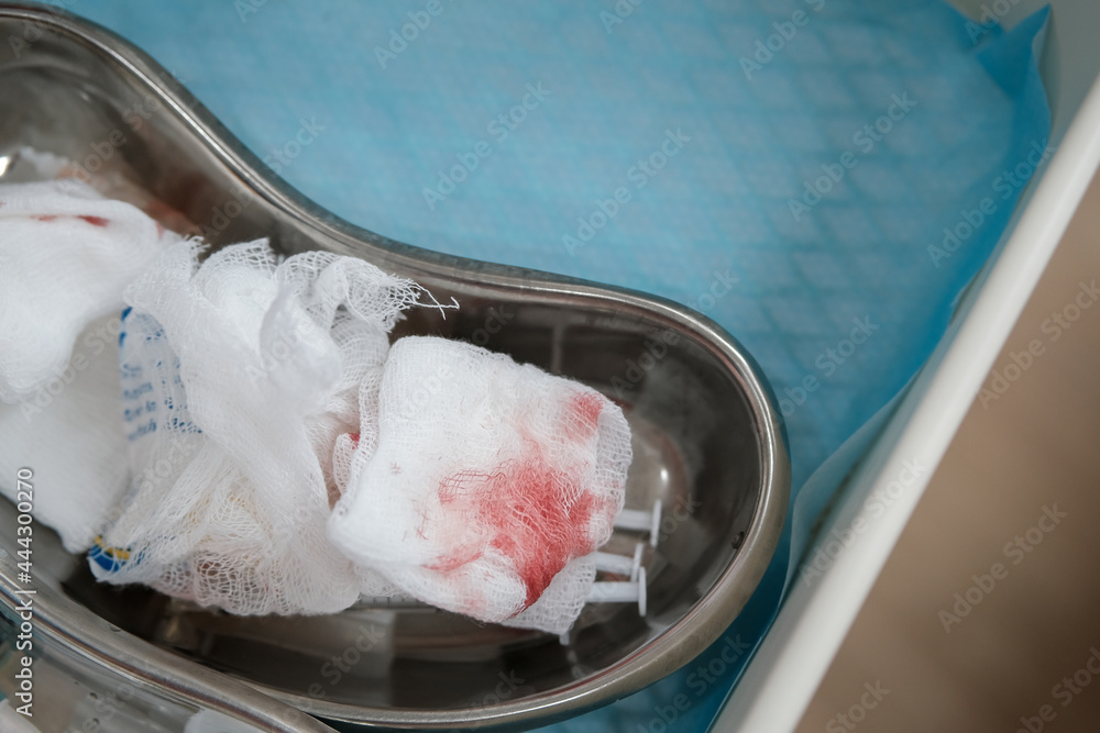 Medical waste, used surgery supplies and first aid concept with roll of ...