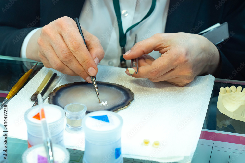 Prosthodontics work. Creation of Prosthetic teeth. Making dentures ...