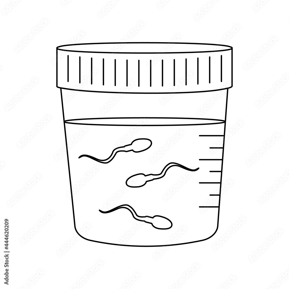 Semen Analysis Sample
