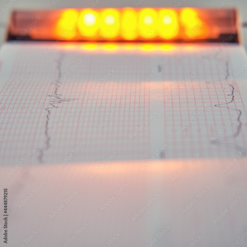 CTG device with monitoring of the state of health of the mother and ...