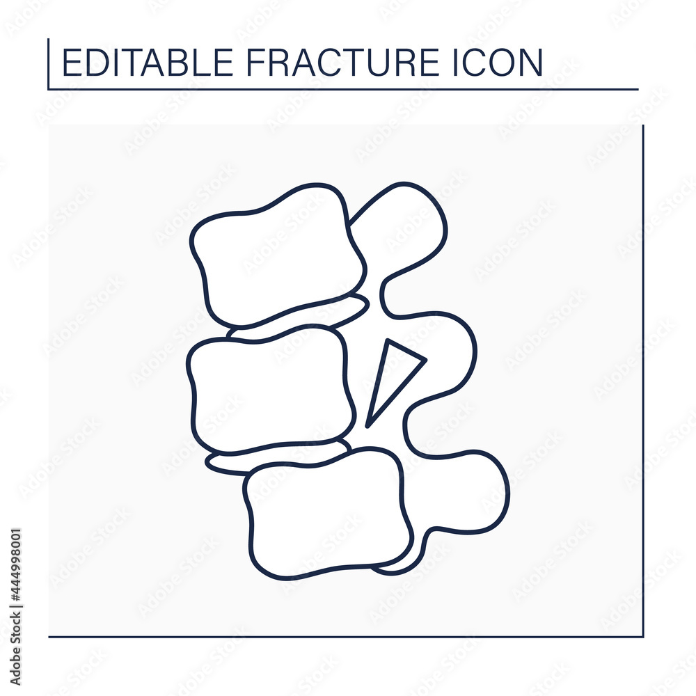 Fracture dislocation line icon. Piece of bone remains jammed between ...