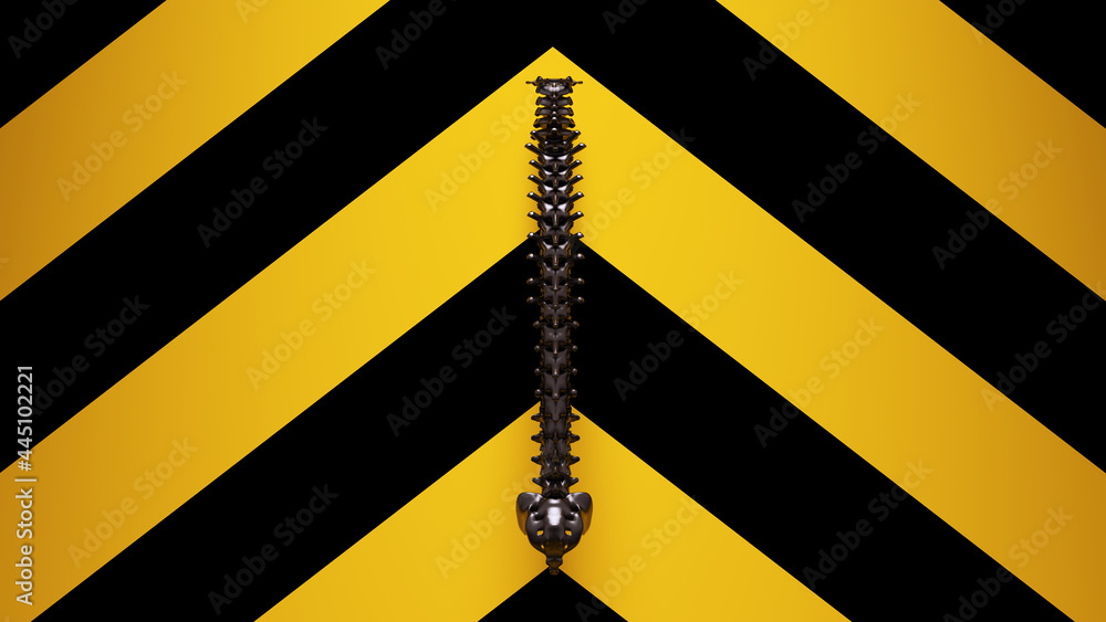 Yellow Black Spine Spinal Cord Vertebrae with Yellow an Black Chevron ...